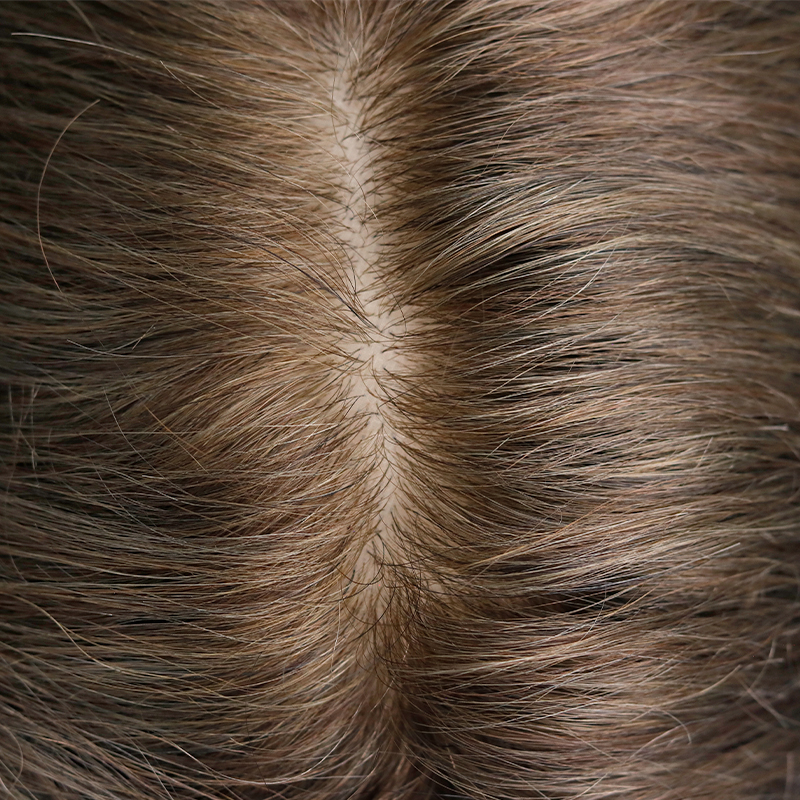 LaVividHair® Official Blog - Toupees, Hair Systems, Hair Patches