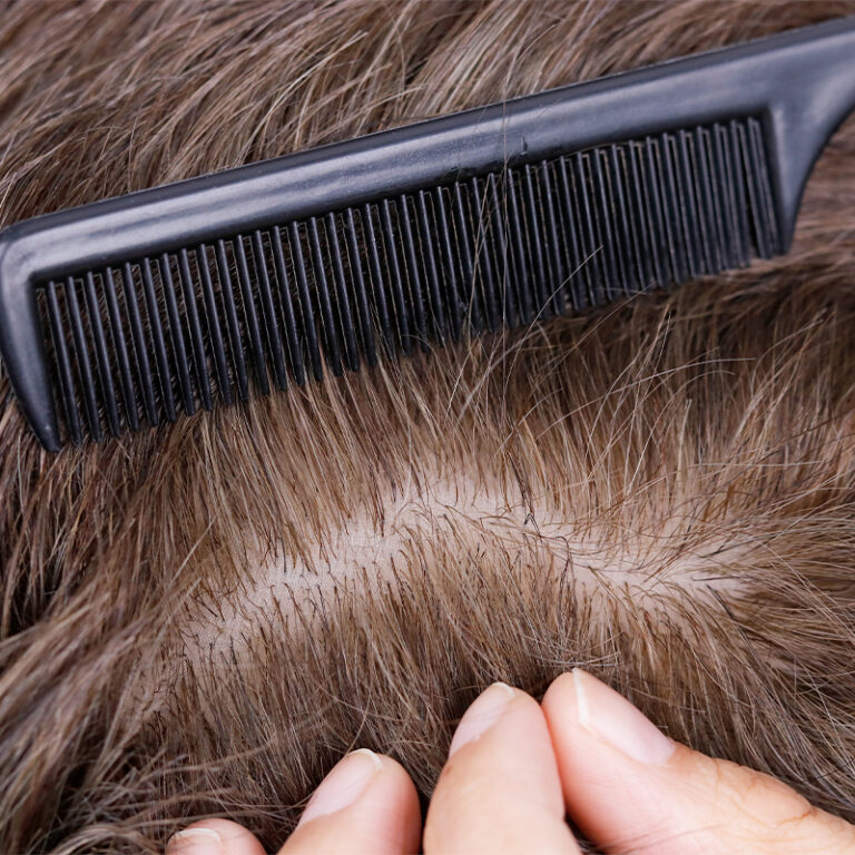 LaVividHair® Official Blog - Toupees, Hair Systems, Hair Patches